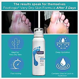 Footlogix Very Dry Skin Formula 3