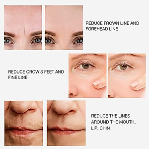 Radio Frequency Machine Professional 25 Watts Face RF Increase Collagen Firm Skin Wrinkle Reducing