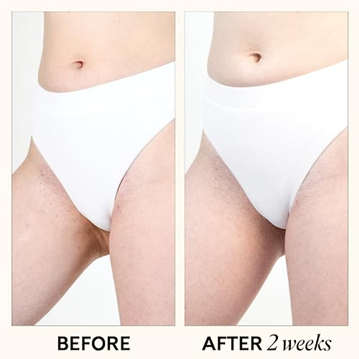 Fur Ingrown Eliminator Serum: Post Hair Removal Care and Ingrown Hair Treatment - 1.1 FL OZ