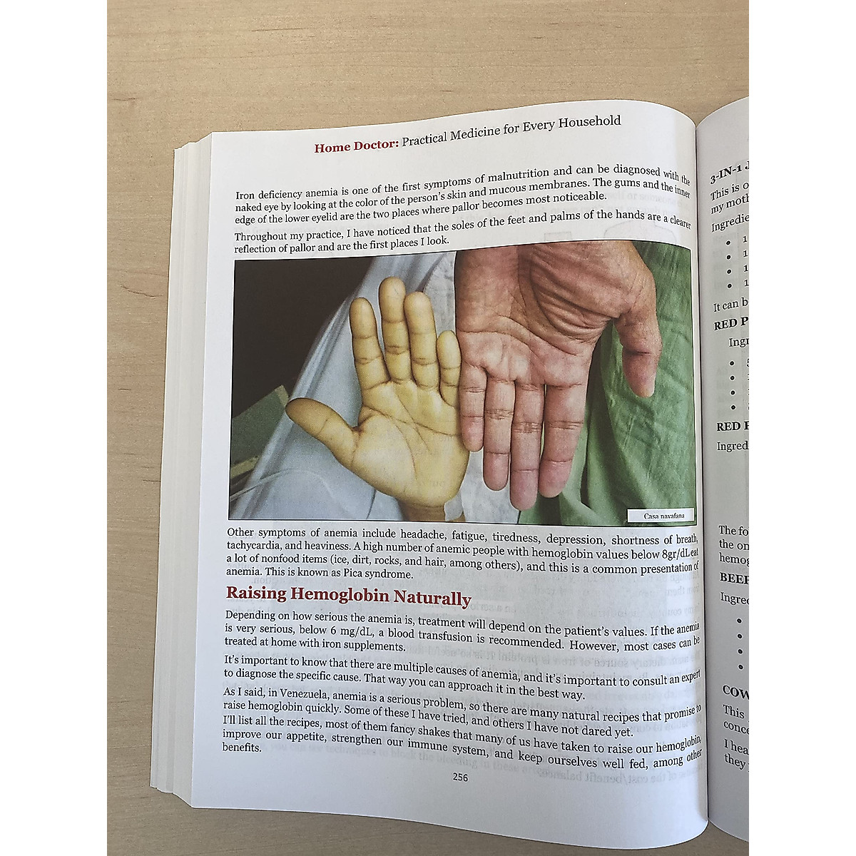 Home Doctor - Practical Medicine for Every Household