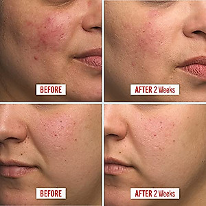 First Aid Beauty Ultra Repair Cream Intense Hydration Moisturizer for Face and Body Bundle – Classic 6 oz Jar + Bonus 1 oz Travel Size Tube