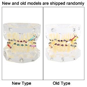 Teeth Educational Model Dental Treatment Malocclusion Study Demonstration Teeth Model with Wire Chain Orange