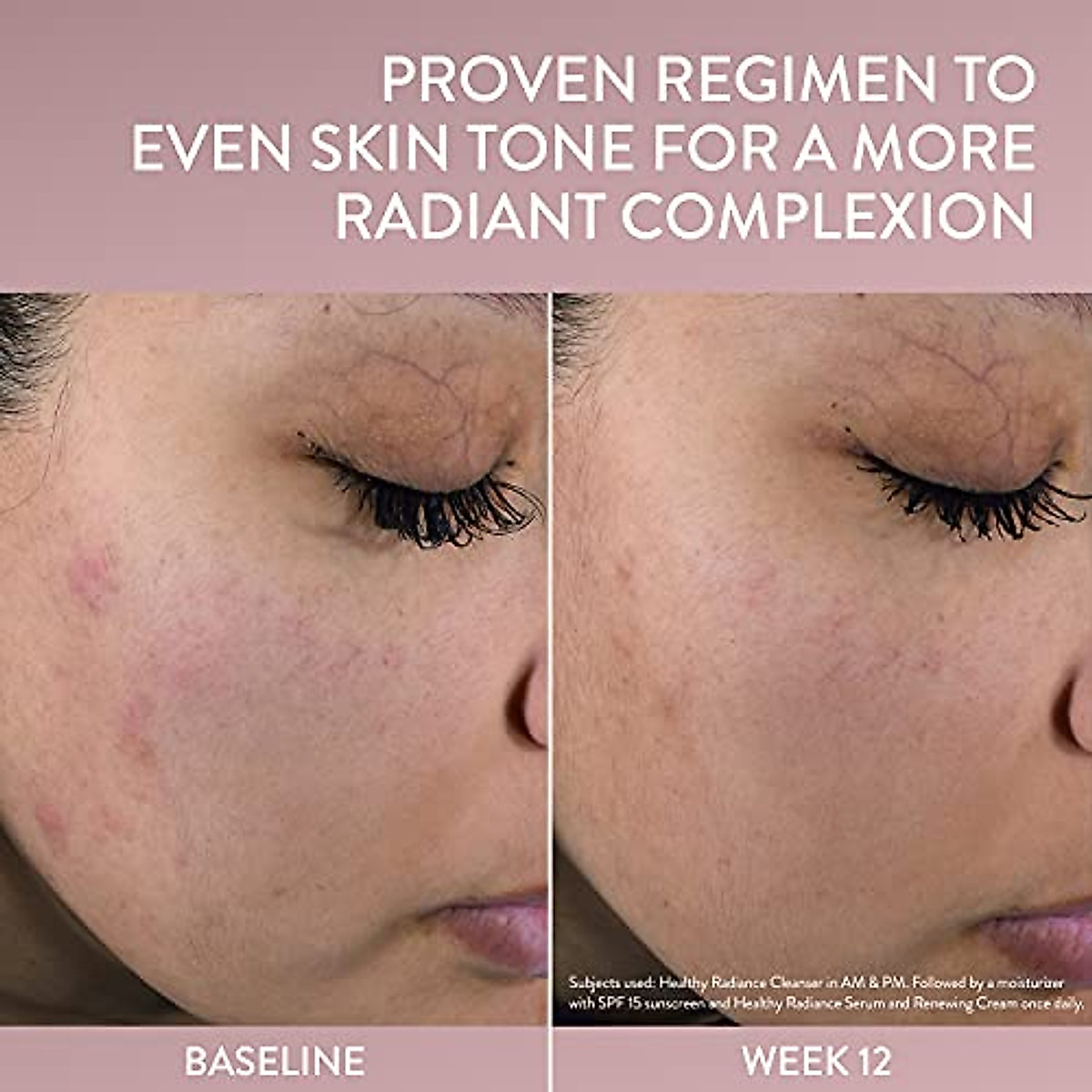 Cetaphil Face Cream, Healthy Radiance Renewing Cream, Visbily Reduces Look of Dark Spots, Brightening Lotion, Designed for Sensitive Skin, Hypoallergenic, Fragrance Free, 1.7oz