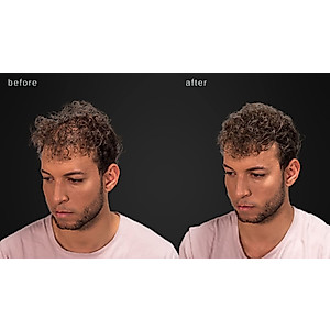 LUXE Hair Thickening Fibers - CONFIDENCE IN A JAR – 2 Months+ Supply! – Hypoallergenic, Dermatologist Tested – Multiple Colors Available (Dark Brown)