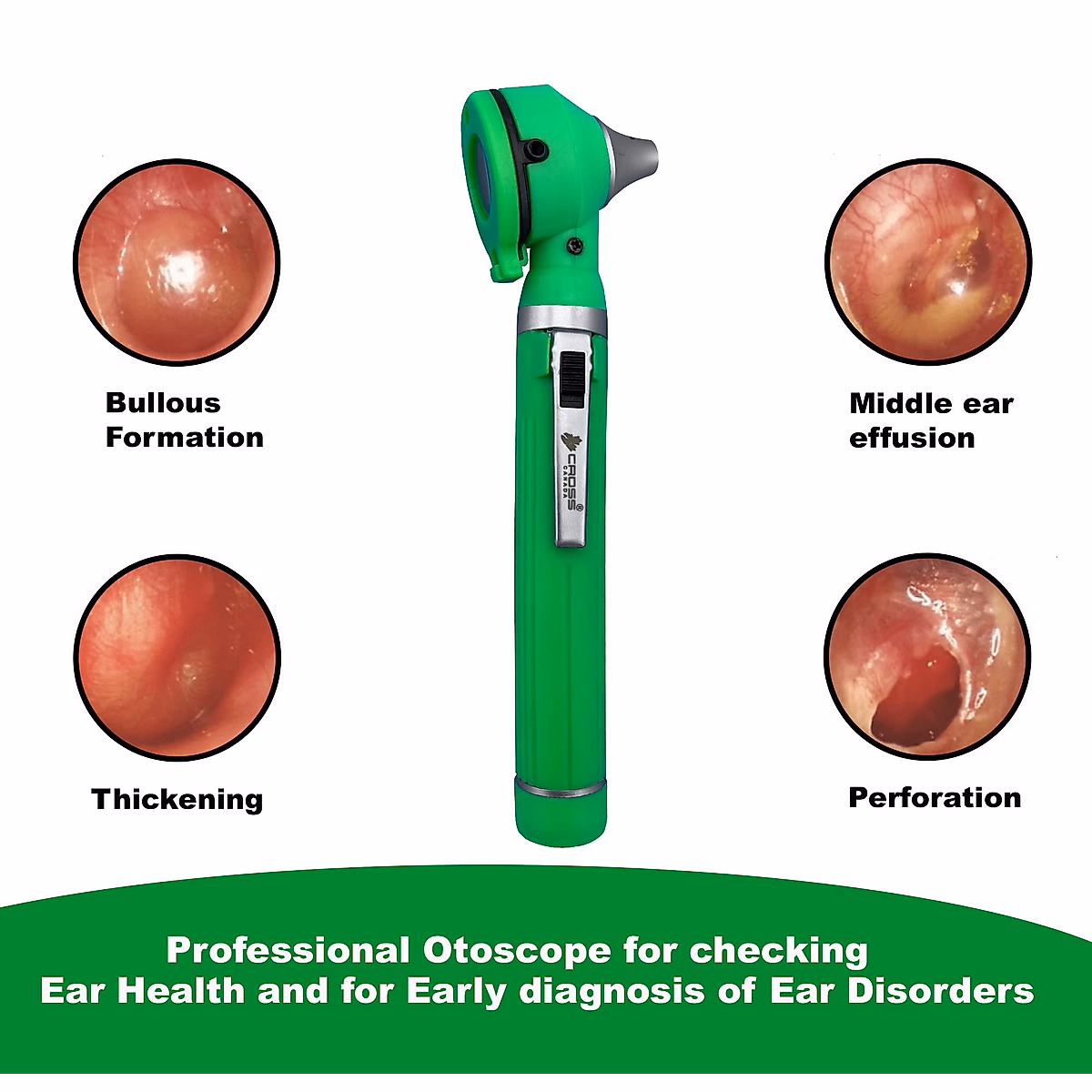 Cross Canada 11-084 Physician Fiber Optic LED Pocket Otoscope Diagnostic Set - Green