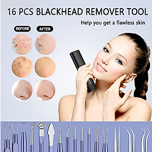 Xesscare Latest Pimple Popper Tool Kit, 16 Pcs Blackhead Remover Tool, Comedone Extractor Acne Removal Kit, Professional Whitehead Tweezers with Metal Case for Facial, Nose and Forehead (Purple)