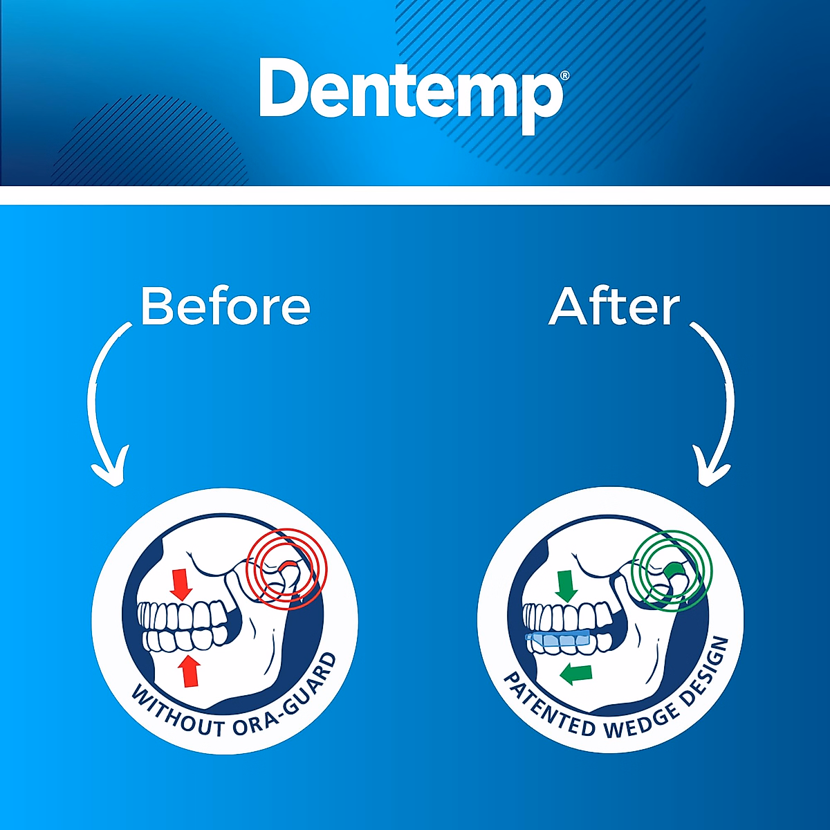 Dentemp Ora-Guard Custom Fit Dental Guard - Bruxism Night Guard for Teeth Grinding - Mouth Guard for Clenching Teeth at Night - Comfortable Mouth Guard for Sleeping - Relieve Soreness in Jaw Muscles…