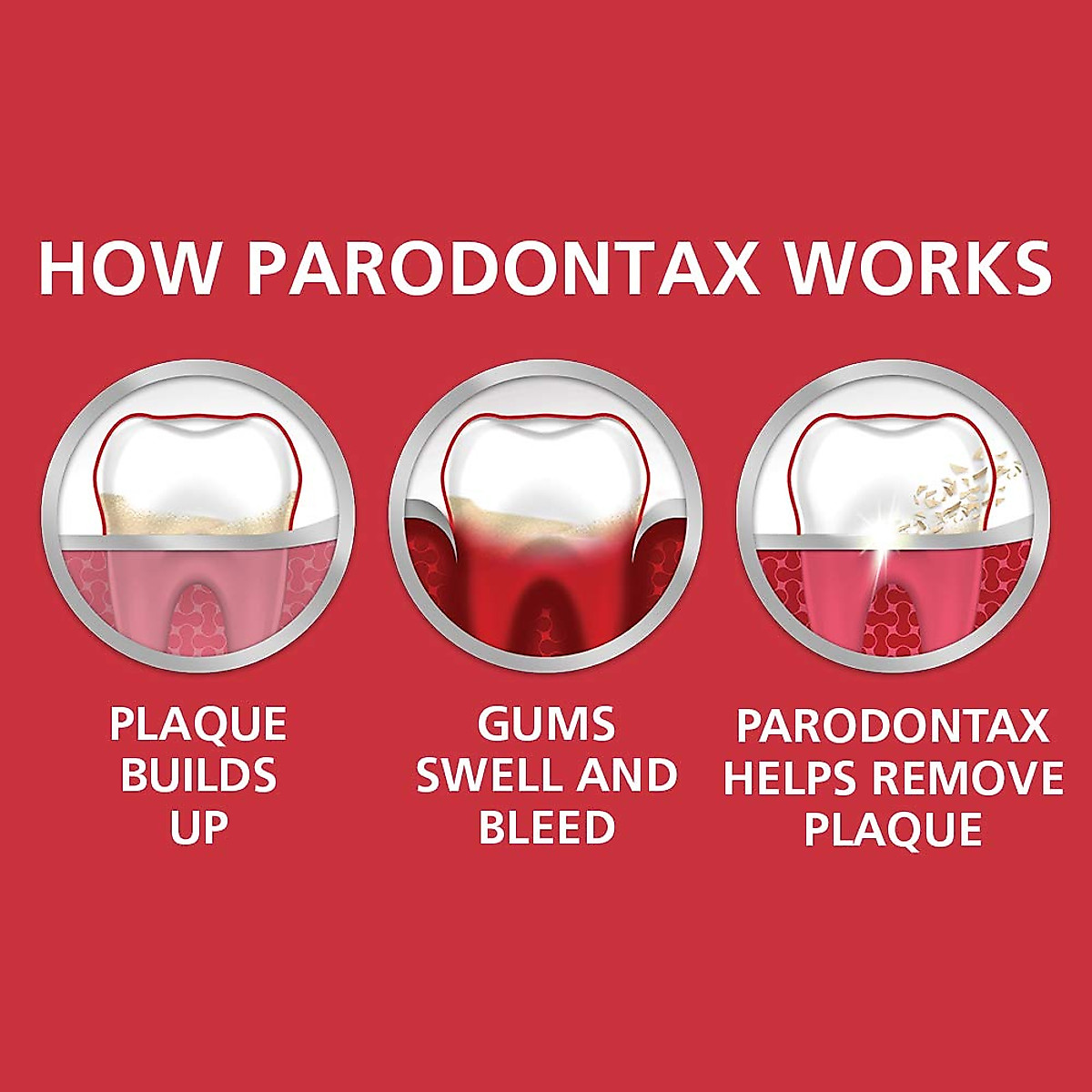 Parodontax Complete Protection Toothpaste for Bleeding Gums, Gingivitis Treatment and Cavity Prevention, Pure Fresh Mint - 3.4 Ounces