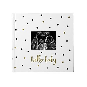 Pearhead Hello Baby Photo Album, Baby Book Keepsake for New and Expecting Parents, Gender-Neutral Baby Accessory, Holds 200 Photos, Black and Gold Polka Dot