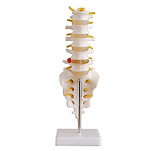 tinsay Anatomical Human Spine Model Consists of 5 Lumbar Vertebrae with Intervertebral Discs,Lumbar Nerves and Spinal Cord.