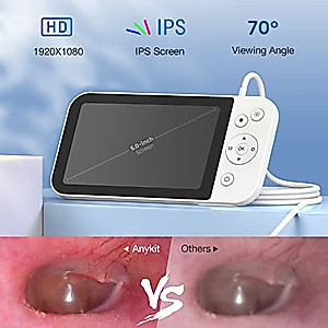 Ear Wax Removal Camera, Visual Ear Cleaner with 5" IPS Screen, Digital Otoscope with Ear Cleaning Tool, 32G Card, HD Video Ear Scope Supports Photo Snap and Video Recording.