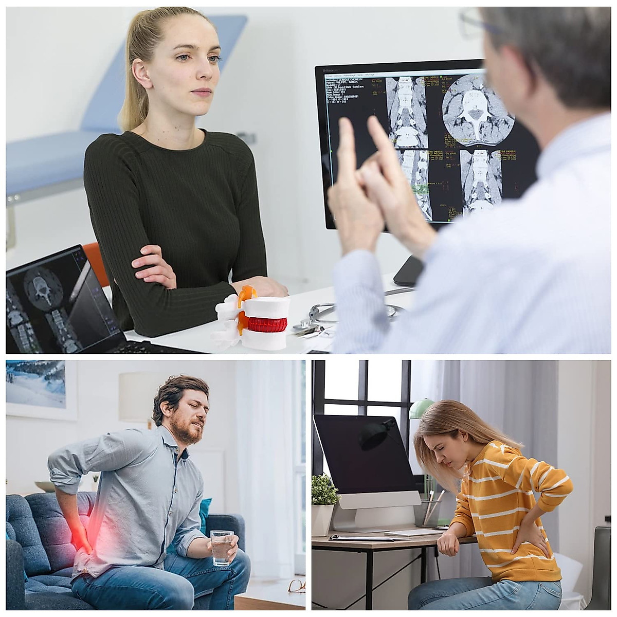 ASINTOD Human Anatomy Lumbar Disc Herniation Model,A Model Showing The Anatomy of Human Lumbar Disc, An Excellent Choice for Teaching and Learning The Human Lumbar Spine