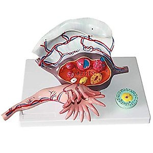 DEAVER Uterine Anatomy Model Ovarian Enlargement Model Skin and Genitourinary System Anatomical Medical Educational Training Aid,Medical Models & Educational Materials