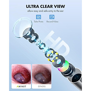 Anykit 3.9 mm Visual Digital Otoscope with 6 LED Lights and Earwax Removal Tool for Adults & Children, Compatible with iPhone & Android