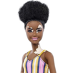 Barbie Fashionistas Doll #135 with Natural Curly Hair and Vitiligo Wearing Striped Dress and Accessories