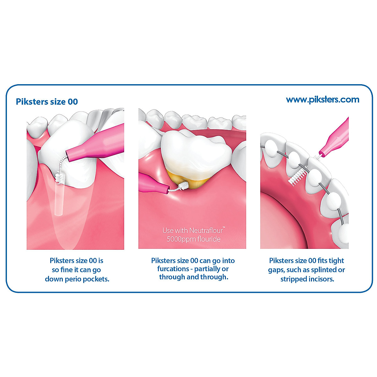 Piksters Interdental Brushes, 40 pk, Size 00, Interdental Tooth Brush for Extremely Tight Gaps, Gum Soft Bristles for Plaque Removal, Safe for Braces