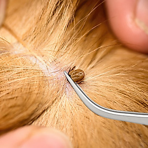 Rypet Tick Remover Tool Set - Stainless Steel Tick Remover Kit for Cats Dogs and Humans(Pack of 3)