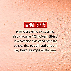 First Aid Beauty KP Bump Eraser Body Scrub Exfoliant for Keratosis Pilaris with 10% AHA 2 oz.