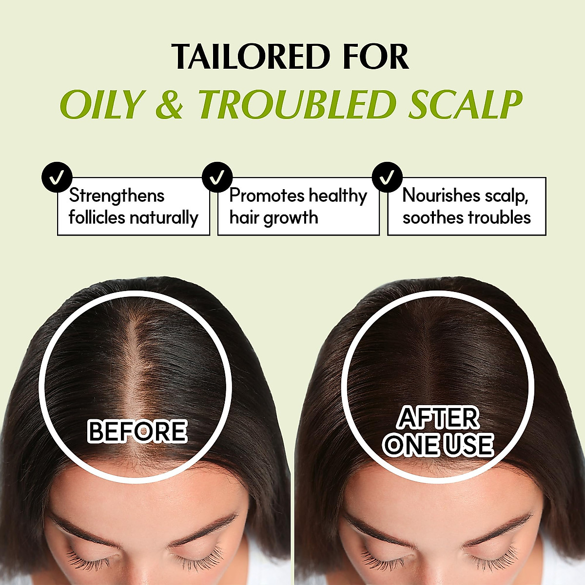 RATED GREEN REAL MARY Energizing Biotin Hair Growth Spray for Thinning Hair and Scalp for Men & Women - Rosemary and Ginger Scalp Spray | 4.06 fl oz