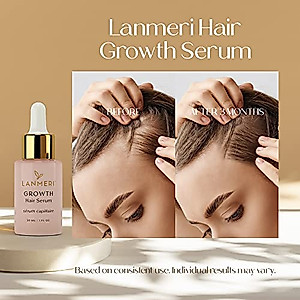 Lanmeri Vegan Hair Growth Serum - Natural Hair Regrowth and Hair Loss Treatments for Women & Men - Scalp Serum for Thinning Hair and Hair Loss - Fuller-looking, Thicker and Healthier Hair in 90 Days, All Hair Types