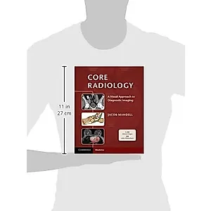 Core Radiology: A Visual Approach to Diagnostic Imaging