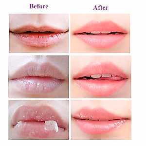 2PCS Bee Balm Lip Balm Honey Pot,Propolis Moisturizing Honey Lip Mask Lip Balm,Hydrating & Prevention Dry and Cracked Lip Scrubs Exfoliator (A)