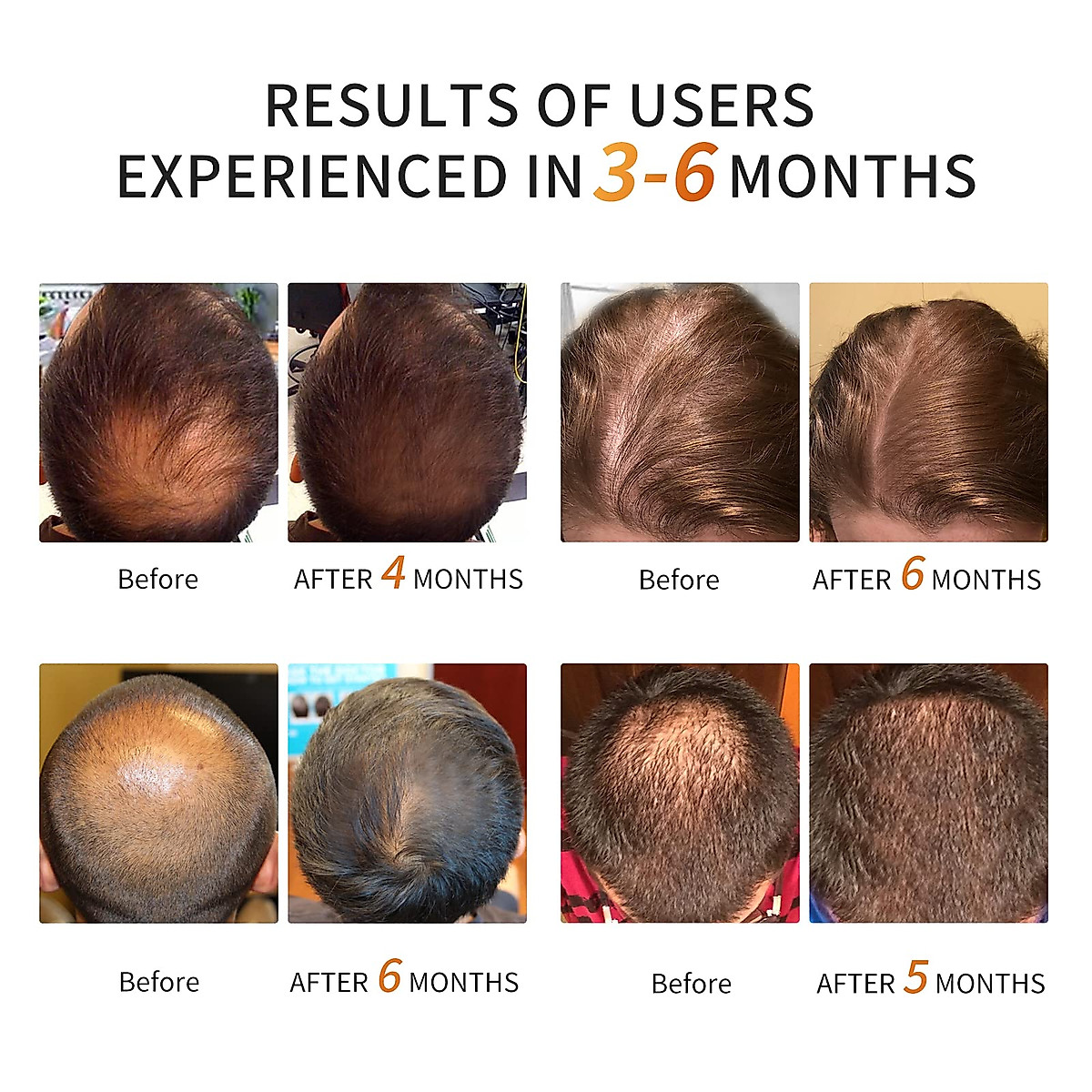 COSBEAUTY Professional Hair Growth Laser Cap - FDA Cleared Low Level Laser Therapy Hair Regrowth for Men & Women, Hair Loss Treatment for Androgenetic Alopecia