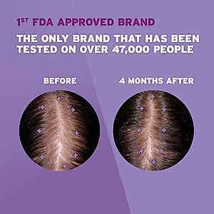 Women's Rogaine Hair Regrowth Treatment (One Month Supply)