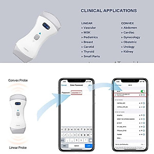 CONTEC Veterinary Wireless Ultrasound Handheld Dual for Animals-Probe Color Doppler Diagnostic System 32 Channel Rechargeable.Suitable for Home,Pets Clinic,Pets Hospital and Other Occasions