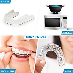 Restwell Dental Nightguard for Teeth Grinding, Bruxing & TMJ Relief, Anti Protector, Clear, 3 Piece Set, 2 Count