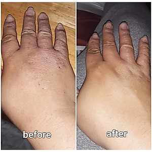 Amir'acle Body Butters & More Luxury Hydrating Cream for Dry, Itchy, and Irritated Skin - Infused with Organic Shea Butter, Calendula, Neem Oil, and Essential Oils (2 ounce)