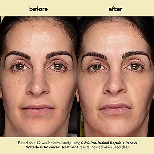 boscia 0.6% Pro-Retinol Repair + Renew Waterless Advanced Treatment - Vegan, Cruelty-Free, Natural Skin Care - For Fine Lines & Wrinkles - 1 fl oz