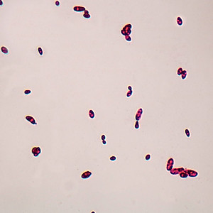 Candida Albicans, W.M. Microscope Slide
