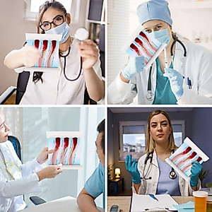 Human Body Skeleton Anatomical Model Low- Density Lipoprotein Blood Vessel Model