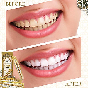 HERBOGANIC Natural Miswak, All Natural Traditional Tooth Brush for Oral Health, Hygiene, Fresh Breath, Light Weight, Vacuum Sealed (Pack of 6)