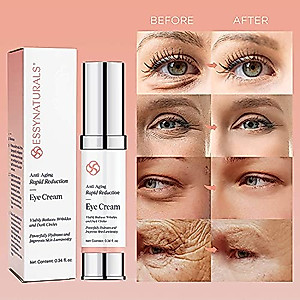 Instant Wrinkle Reduction Serum: Advanced Formula for Dark Circles, Puffiness, and Aging - Lifts, Firms, and Tightens Skin for a Youthful Look in Just 120 Seconds