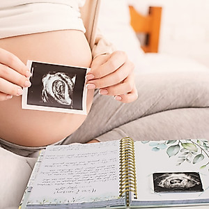 ZICOTO Pregnancy Journal and Memory Book with Stickers and Keepsake Pocket - Lovely Must Have Gift for First Time Moms to Be - The Perfect Planner to Track Your Little Ones Life-Changing Journey