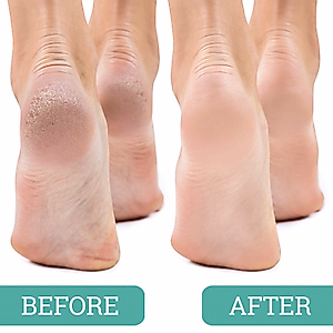 Maccibelle Salon Foot Pumice and Scrubber for Feet and Heels Callus and Dead Skins, Safely and Easily Eliminate Callus and Rough Heels (Pack of 3)