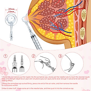 BBTO 8 Pieces Nipple Suction Cups Nipple Corrector Sucker Nipple Pullers Aspirator Women Nipple Flat Inverted for Breastfeeding Silicone with Case (Blue, Pink,1 Inch)