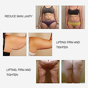 RF Beauty Device | Home RF Lifting | Wrinkle Removal | Anti Aging | Skin Care - Increase Collagen & Absorption - MLAY Professional Radio Frequency Skin Tightening for Face and Body - Salon Effects