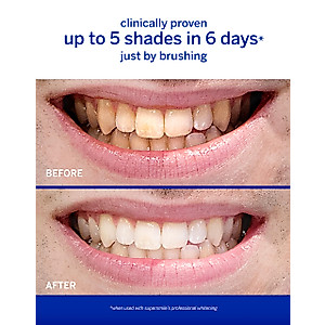 Supersmile Professional Teeth Whitening Toothpaste with Fluoride, Original Mint, 4.2 Oz