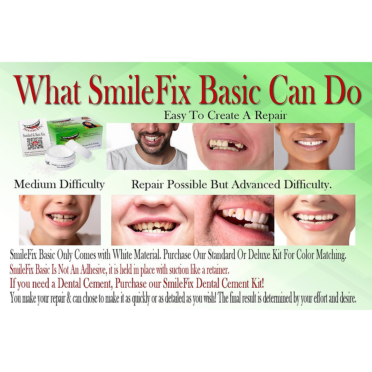 SmileFix Basic Dental Repair - for Missing Or Damaged Teeth - Fix Gaps, Missing Teeth, Spaces, Broken Tooth, Repairs - Fast & Easy - Confident Smiles - BF Products - Durable Compound