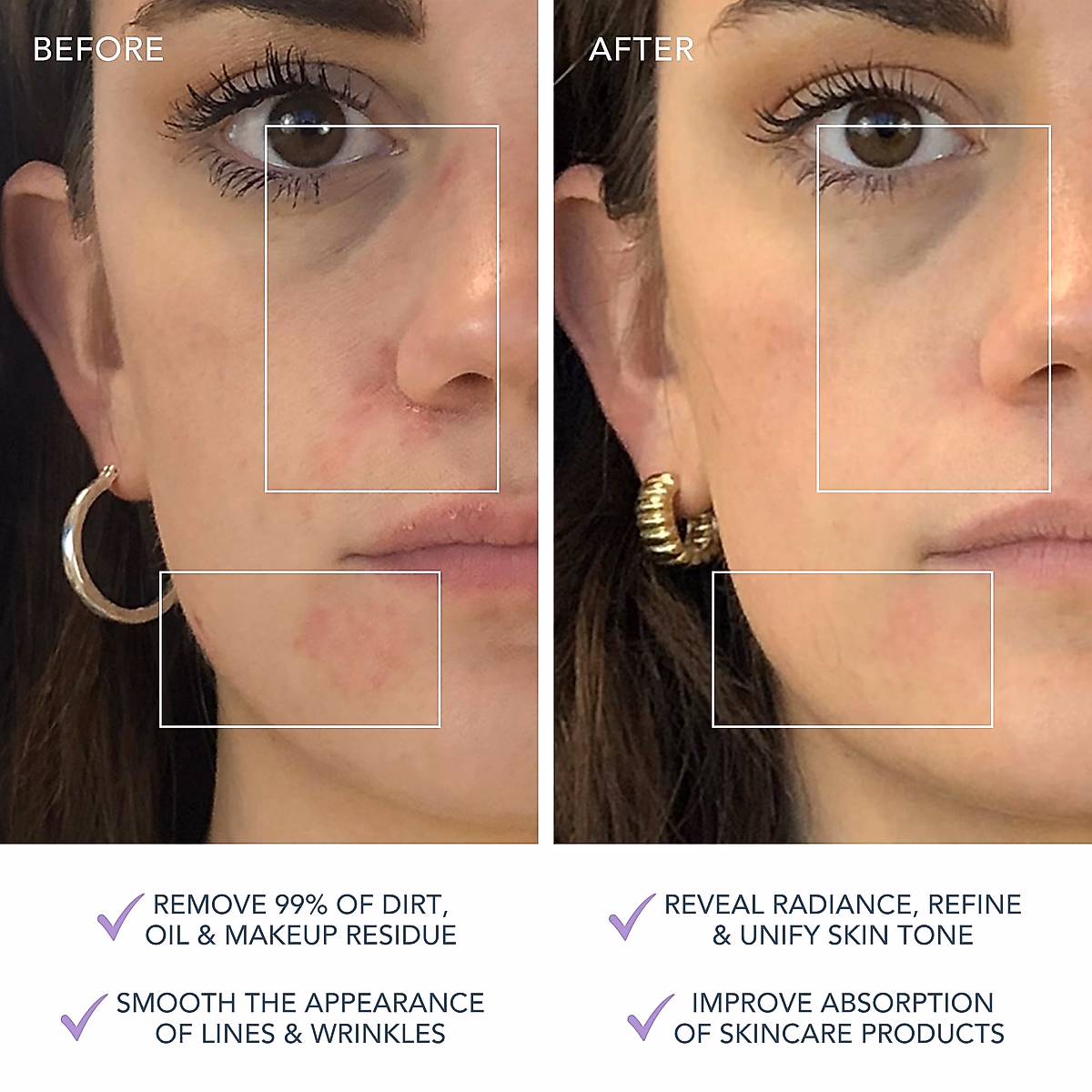 FOREO LUNA 3 Facial Cleansing Brush | Sensitive Skin | Anti Aging Face Massager | Enhances Absorption of Facial Products | For Clean & Healthy Face Care | Simple & Easy | Waterproof