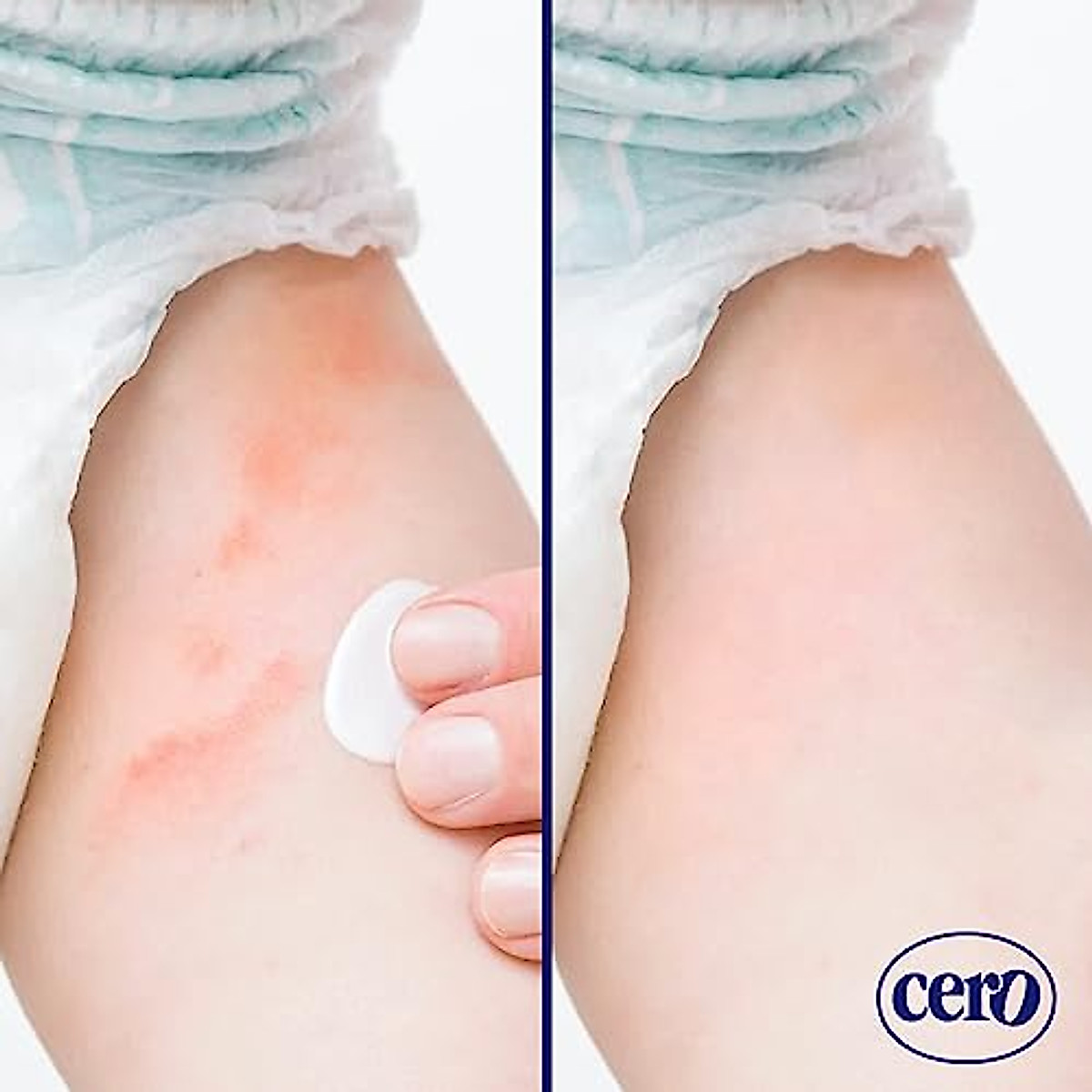 Crema Cero Diaper Rash Cream for Baby with Zinc Oxide and Aloe Vera – High-Strength Diaper Cream for Quick Relief and Protection – Hydrating and Soothing Baby Balm – Aloe Vera 8.5oz