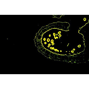 Labomed HD VGA Digital Camera (3.2MP)