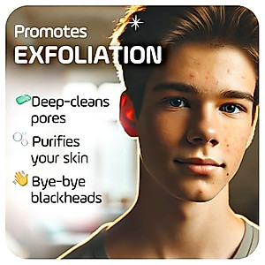 Asepxia with Activated Charcoal Purifying Effect Acne Treatment Bar Soap with Salicylic Acid, 4 Ounce