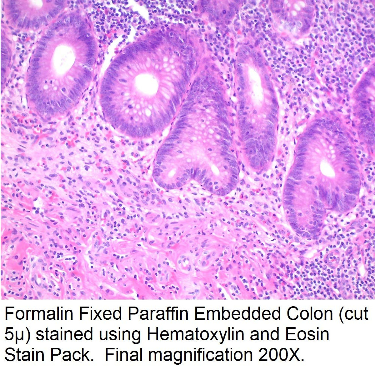 Hematoxylin and Eosin Stain Pack, 1000ml