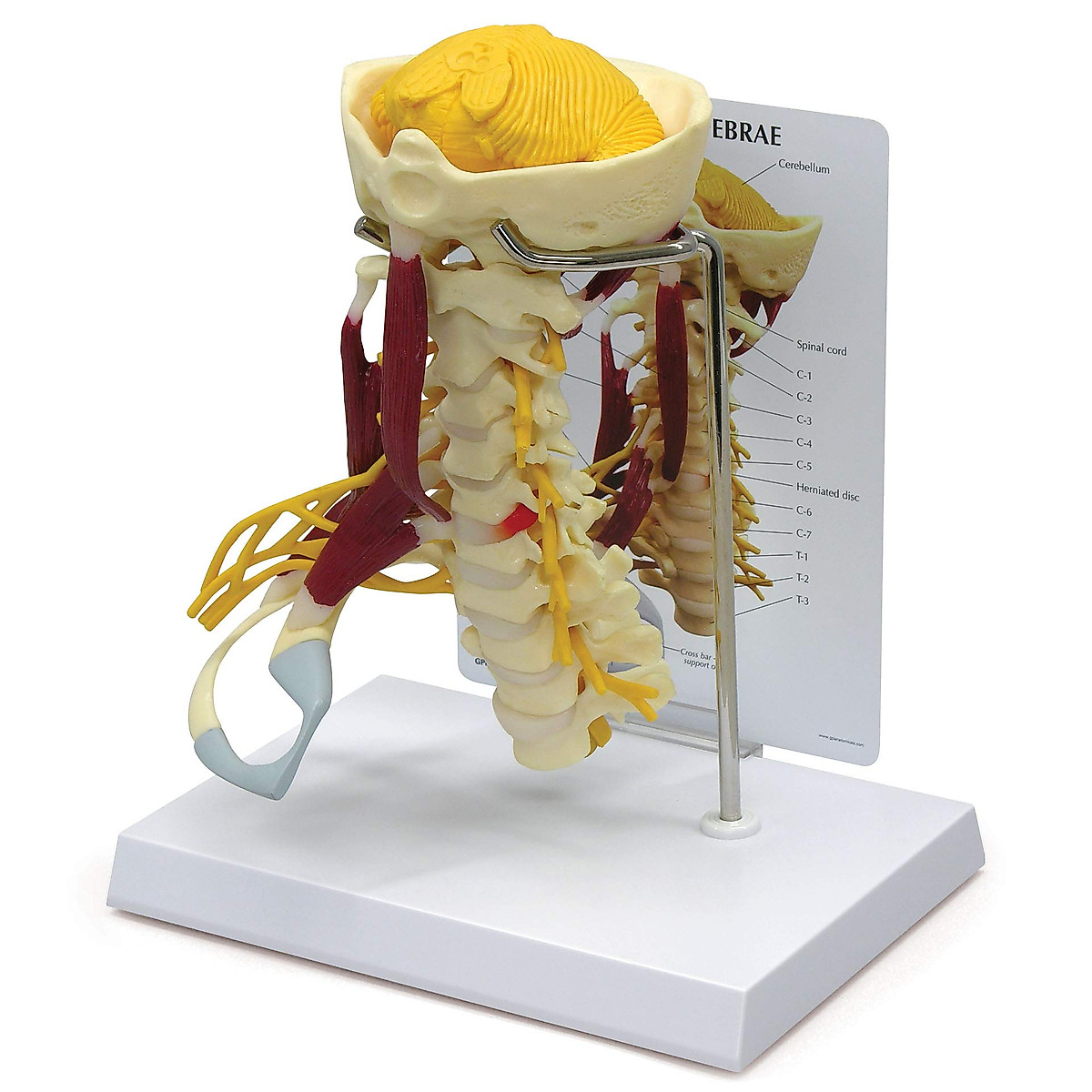 GPI Anatomicals - Deluxe Muscled Cervical Vertebrae Model, Spine Model Replica for Human Anatomy and Physiology Education, Anatomy Model for Doctor's Office and Classrooms, Medical Learning Resources