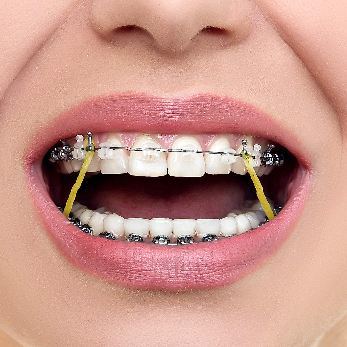 JMU Orthodontic Elastics 1/4 Heavy, 500 pack Intraoral Elastic Bands Latex Dental Rubber Bands Made in USA