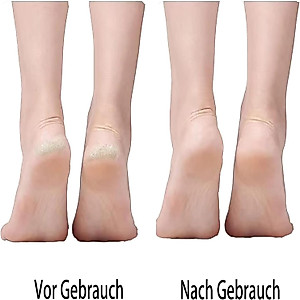 Natural Pumice Stone for Feet - 2 Pack of Foot Pumice Stones for Callus Remover, Exfoliating and Cleaning - Pedicure Tool with Handle and Rope for Hanging in Shower